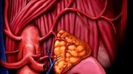 Laparoscopic left adrenalectomy | WebSurg, the online university of IRCAD